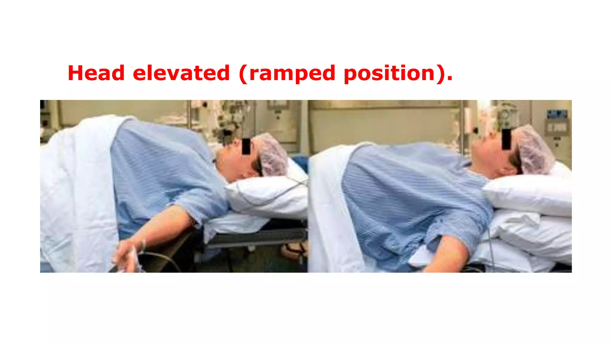 Obstetric Airway Management Guidelines | PPTX