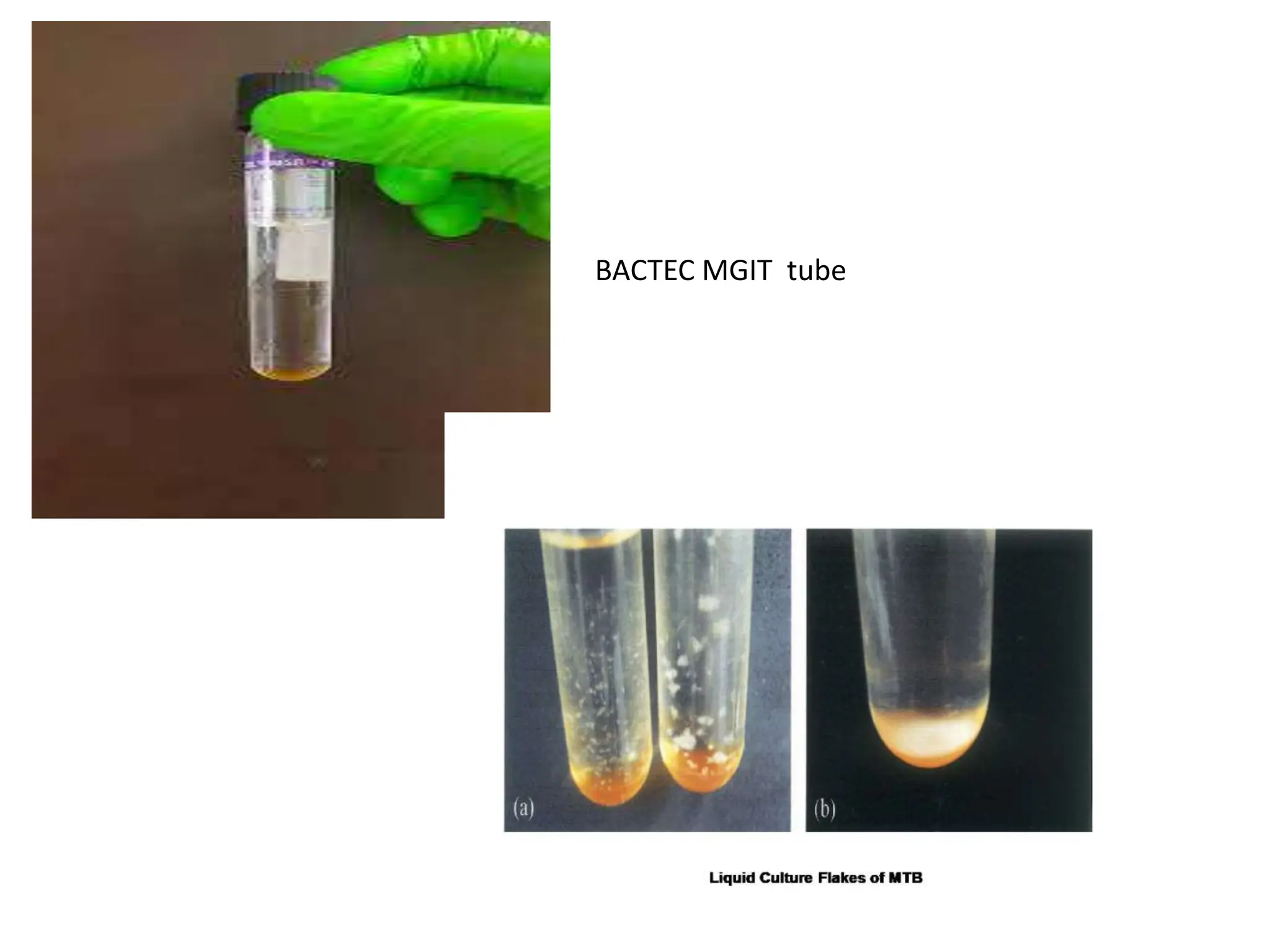 Line Probe Assay for Mycobacterium tuberculosis .pptx