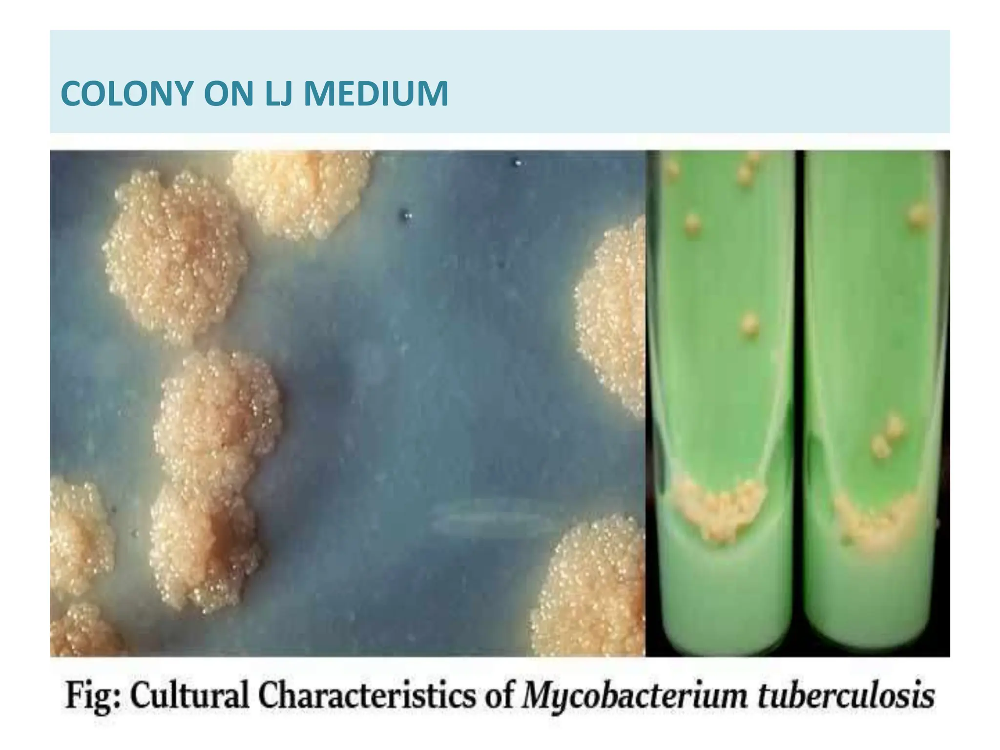 Line Probe Assay for Mycobacterium tuberculosis .pptx