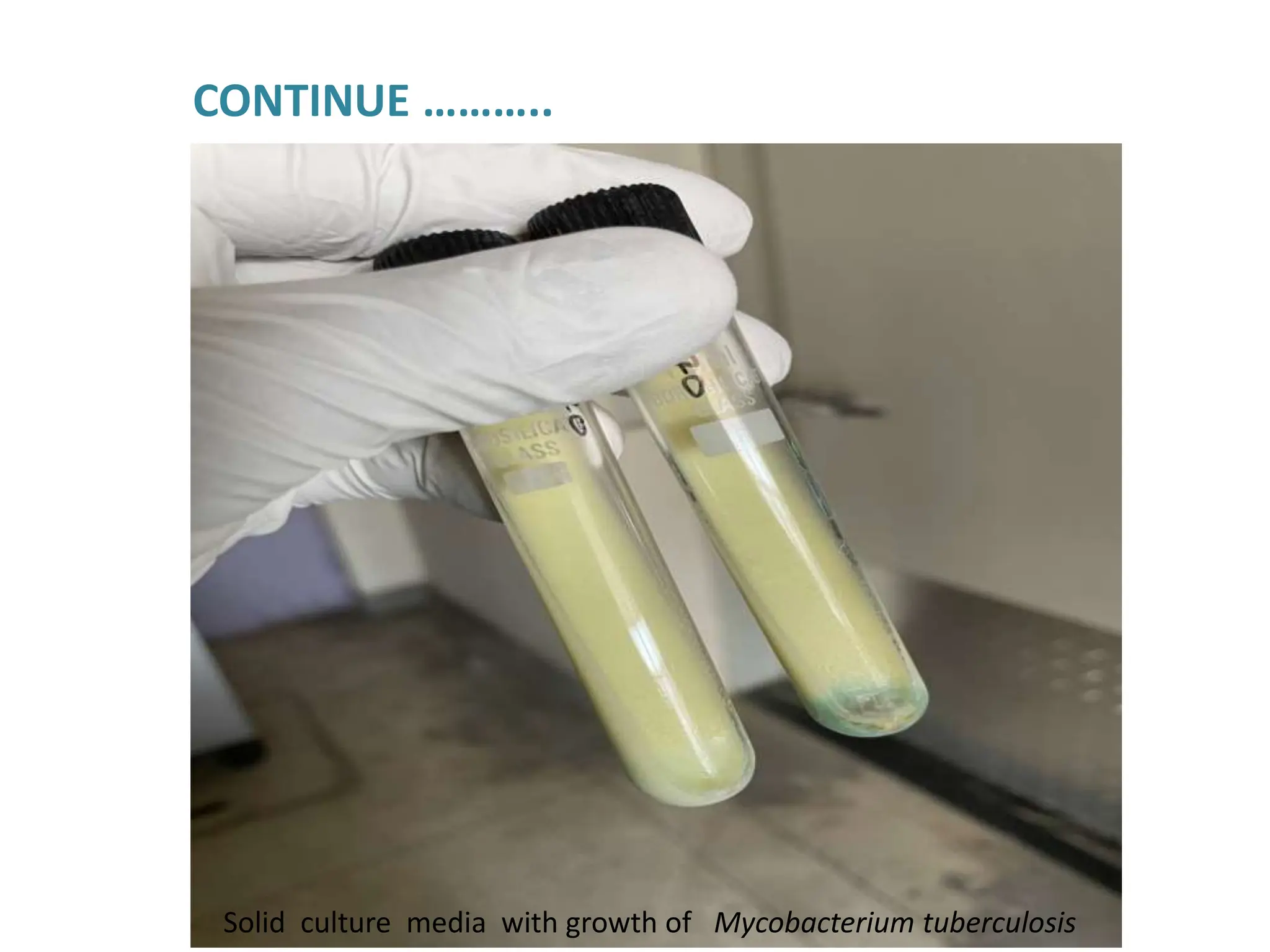 Line Probe Assay for Mycobacterium tuberculosis .pptx