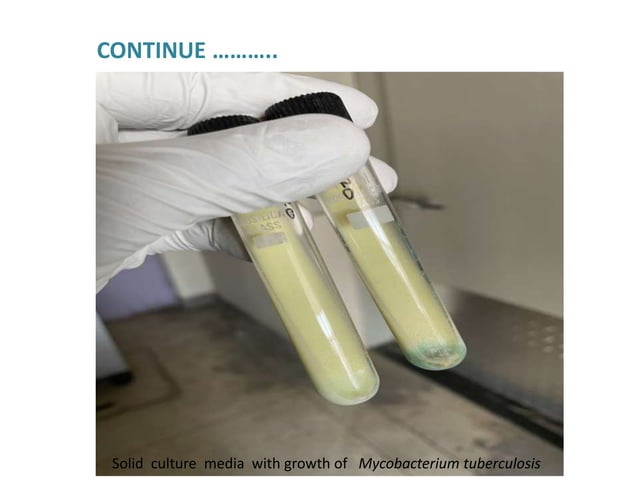 Line Probe Assay for Mycobacterium tuberculosis .pptx