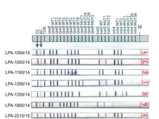 Line Probe Assay for Mycobacterium tuberculosis .pptx