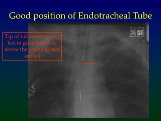 lines_and_tubes (2).ppt