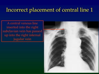 lines_and_tubes (2).ppt