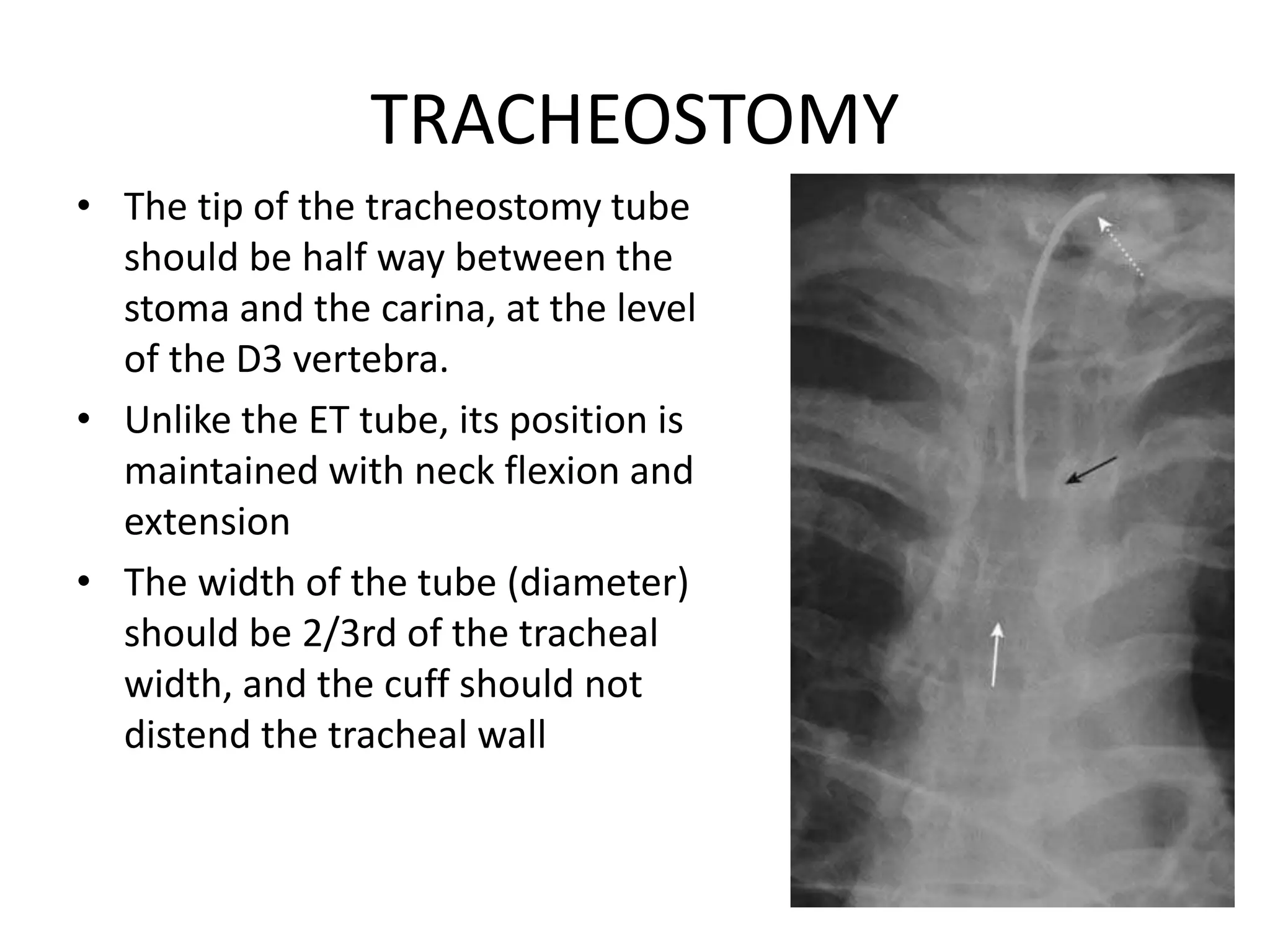 Lines and tubes in xray | PPTX