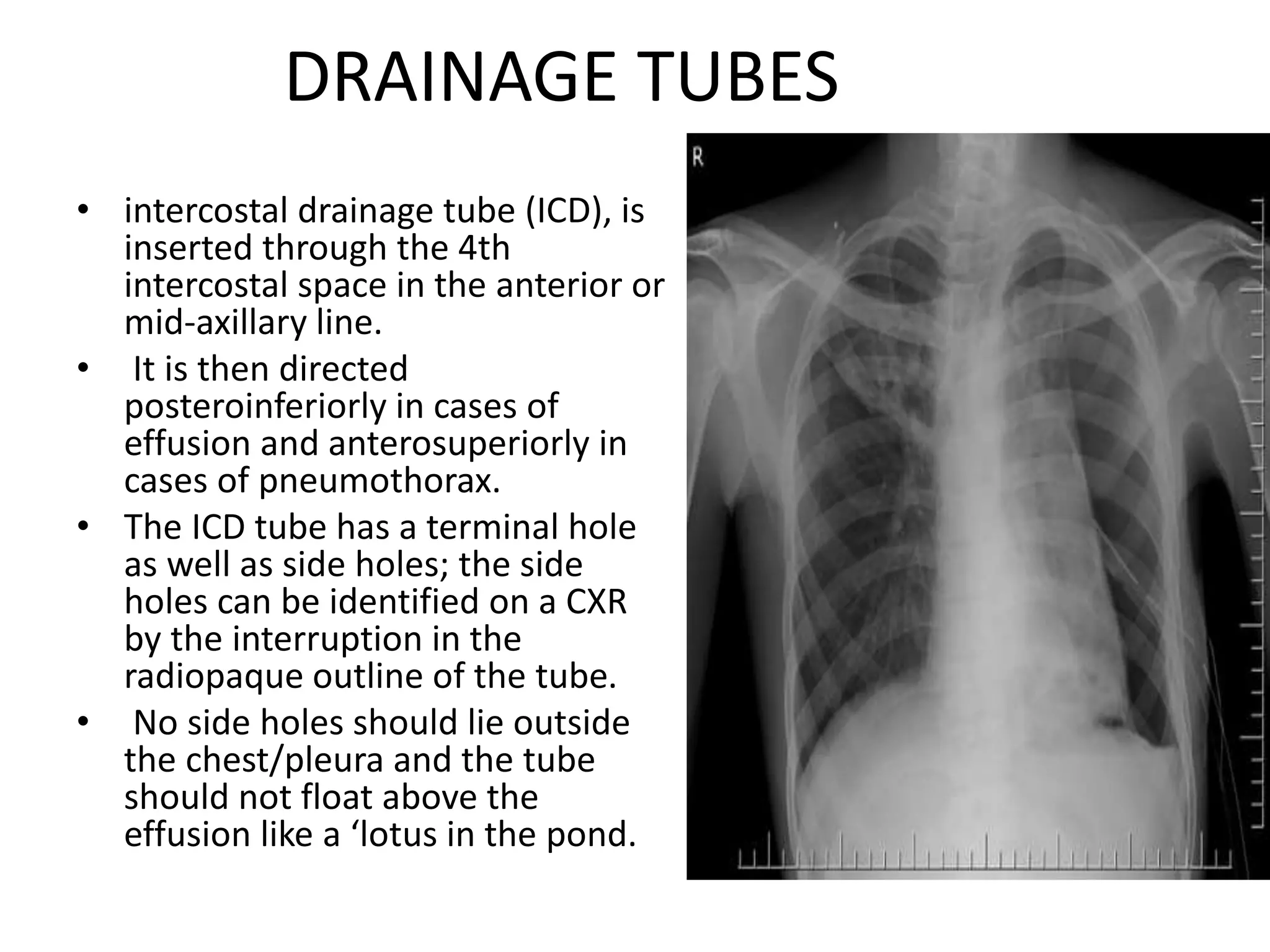 Lines and tubes in xray | PPTX