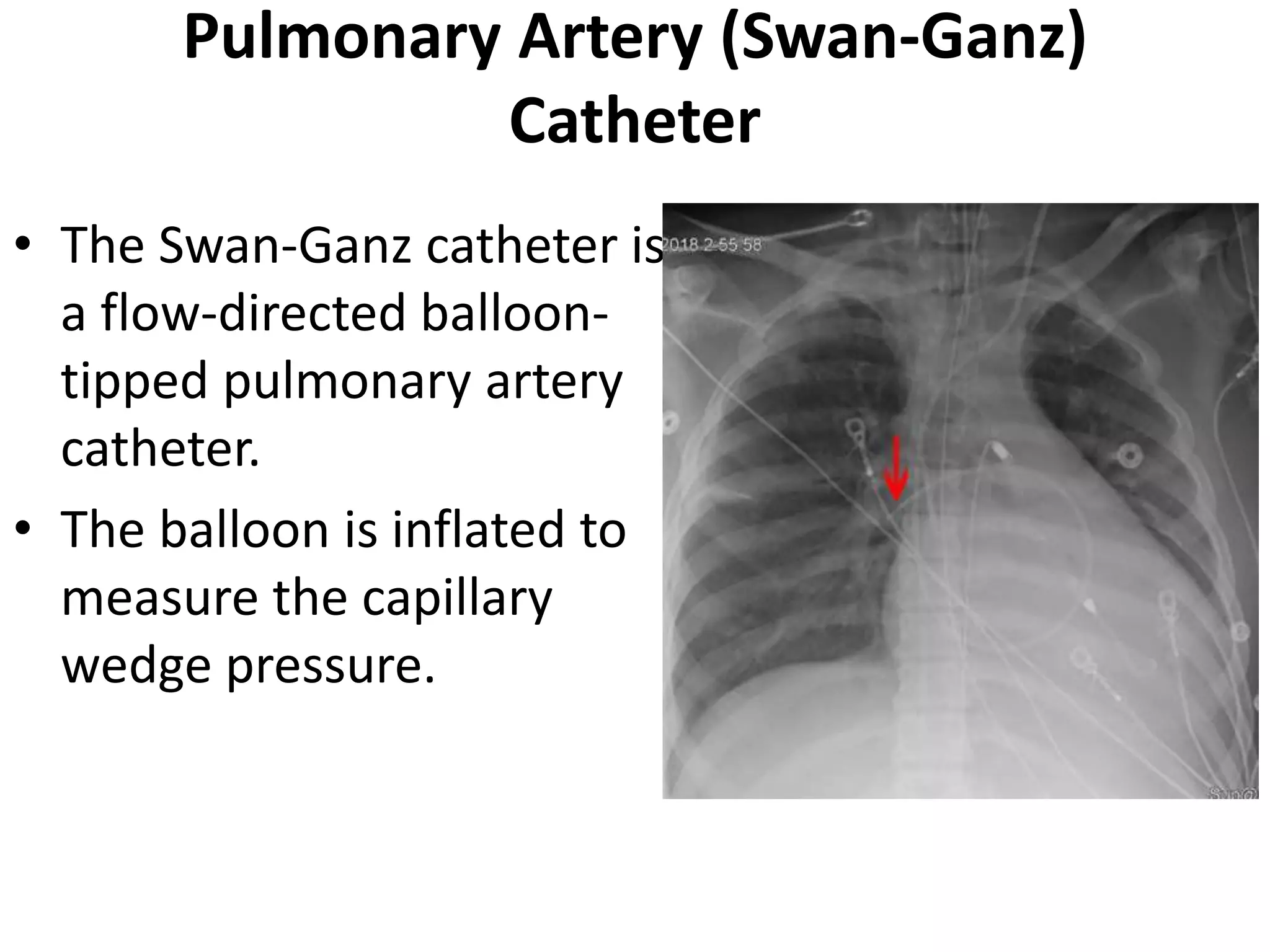 Lines and tubes in xray | PPTX