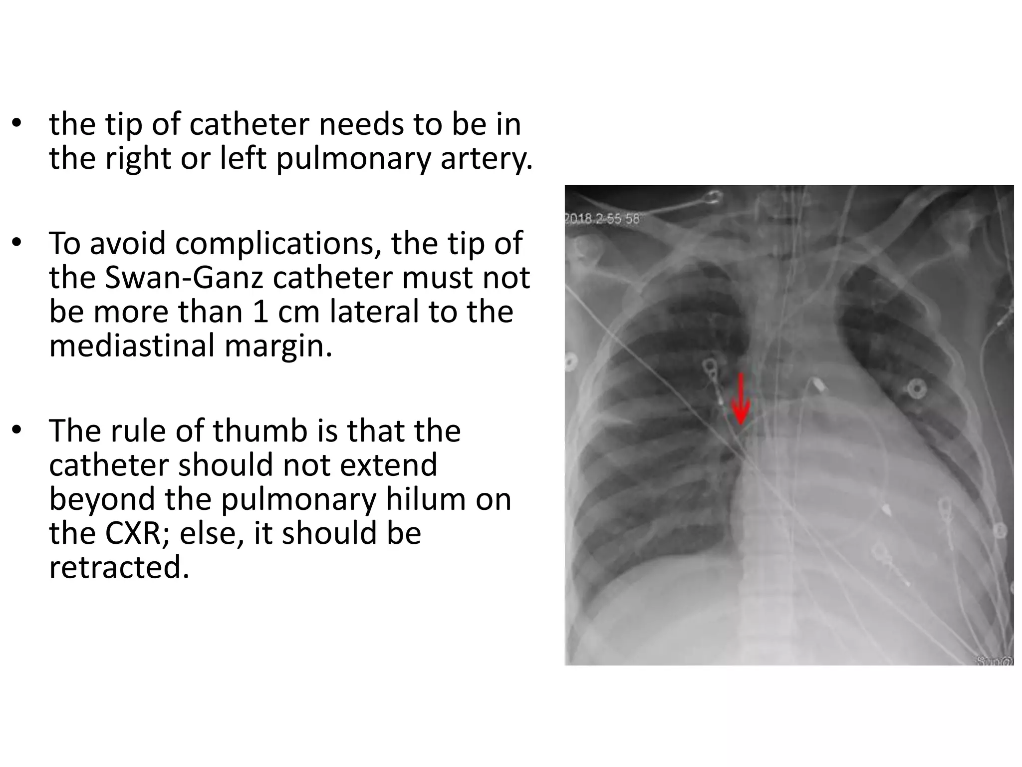 Lines and tubes in xray | PPTX