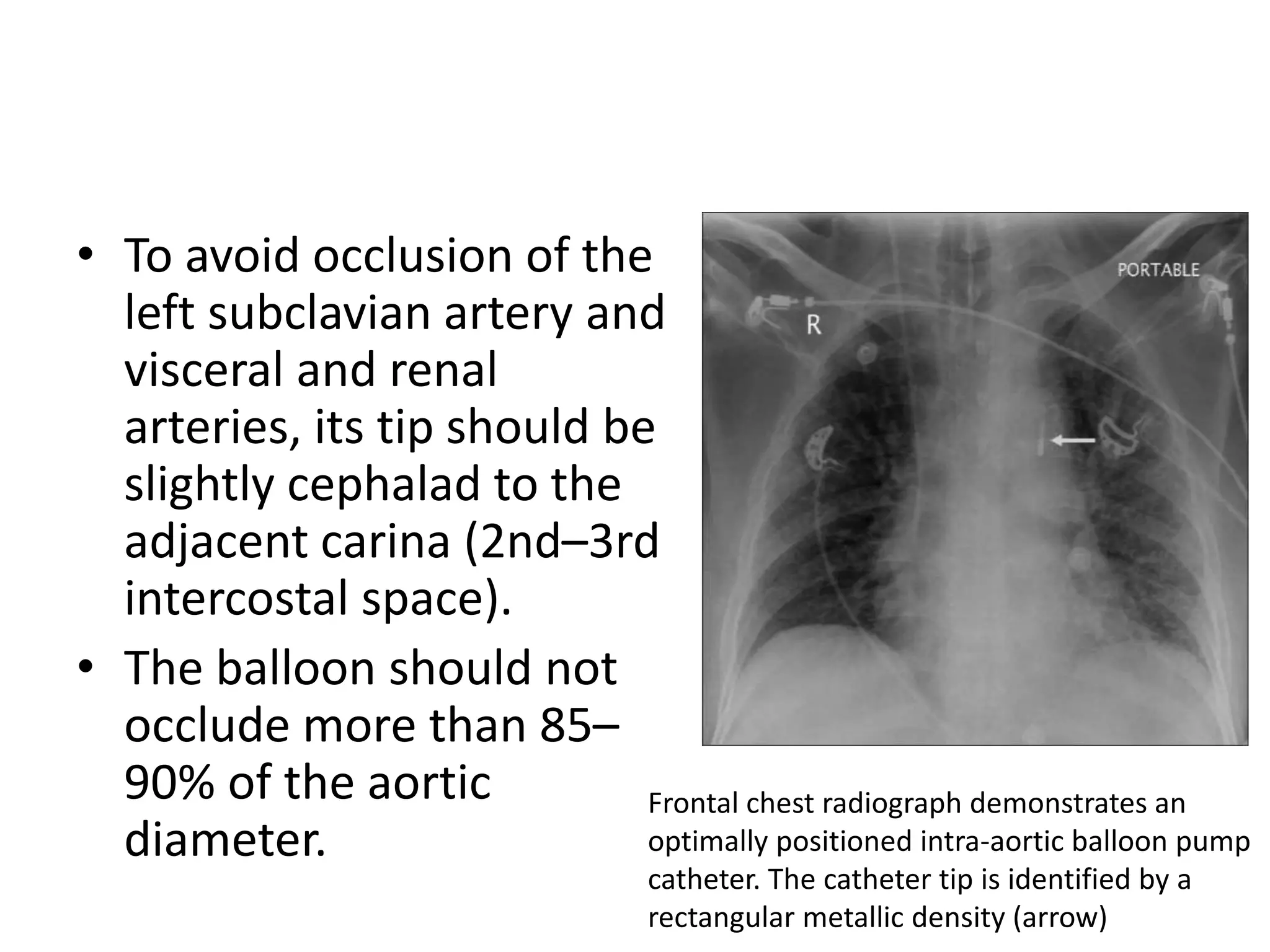Lines and tubes in xray | PPTX