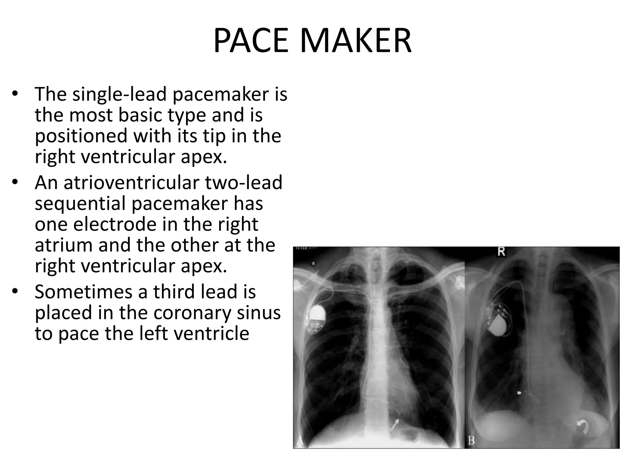 Lines and tubes in xray | PPTX