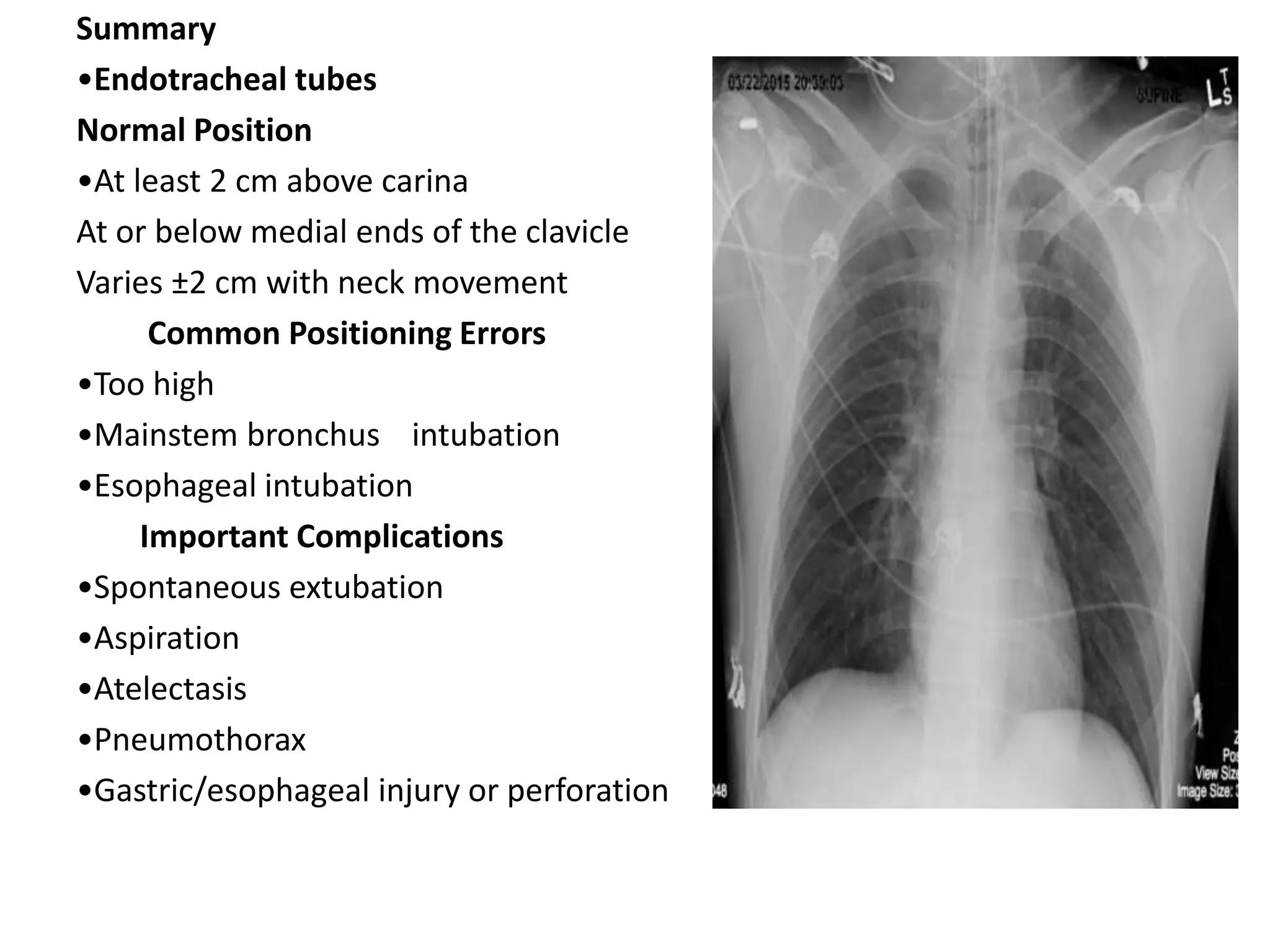 Lines and tubes in xray | PPTX