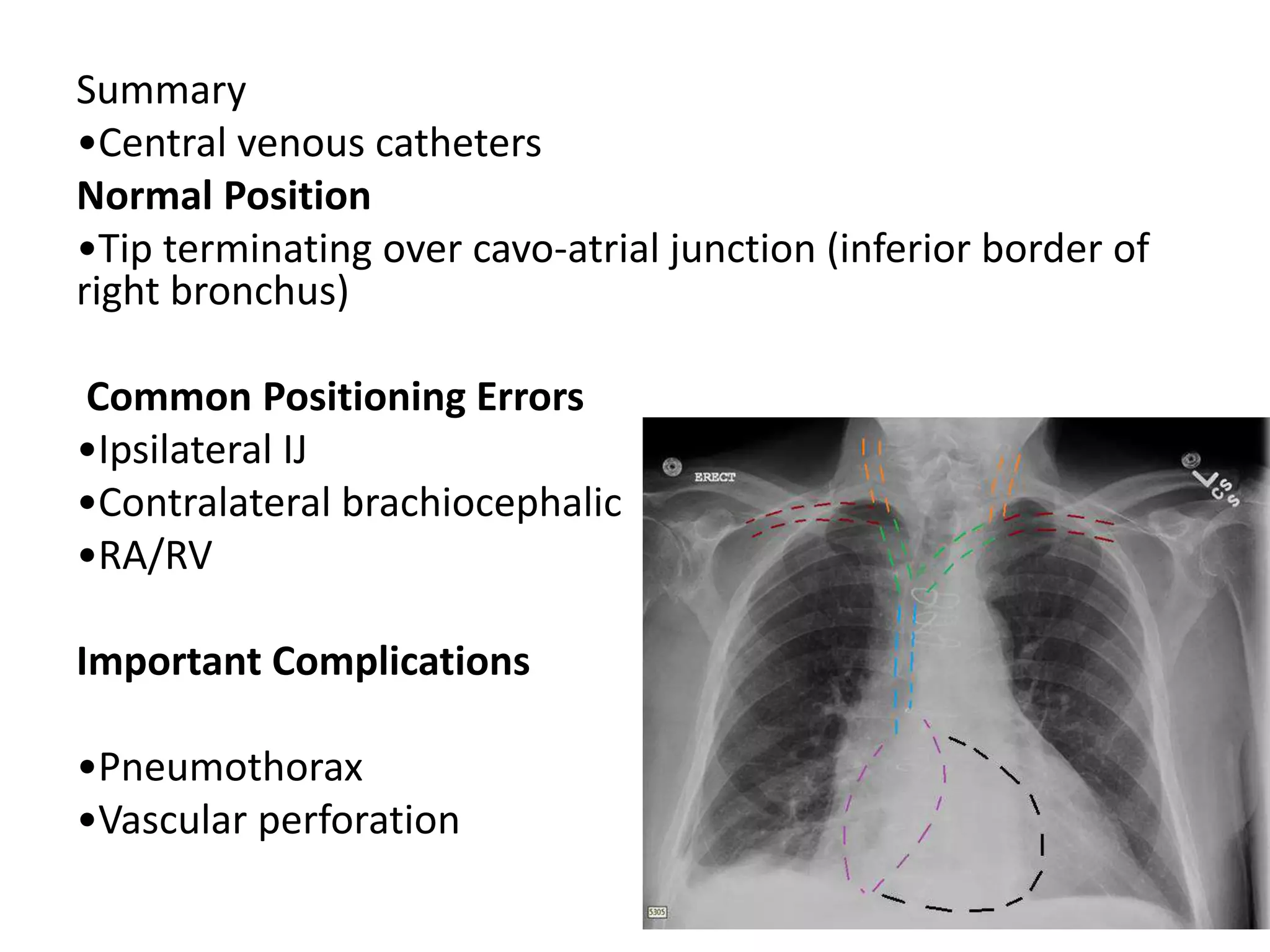 Lines and tubes in xray | PPTX