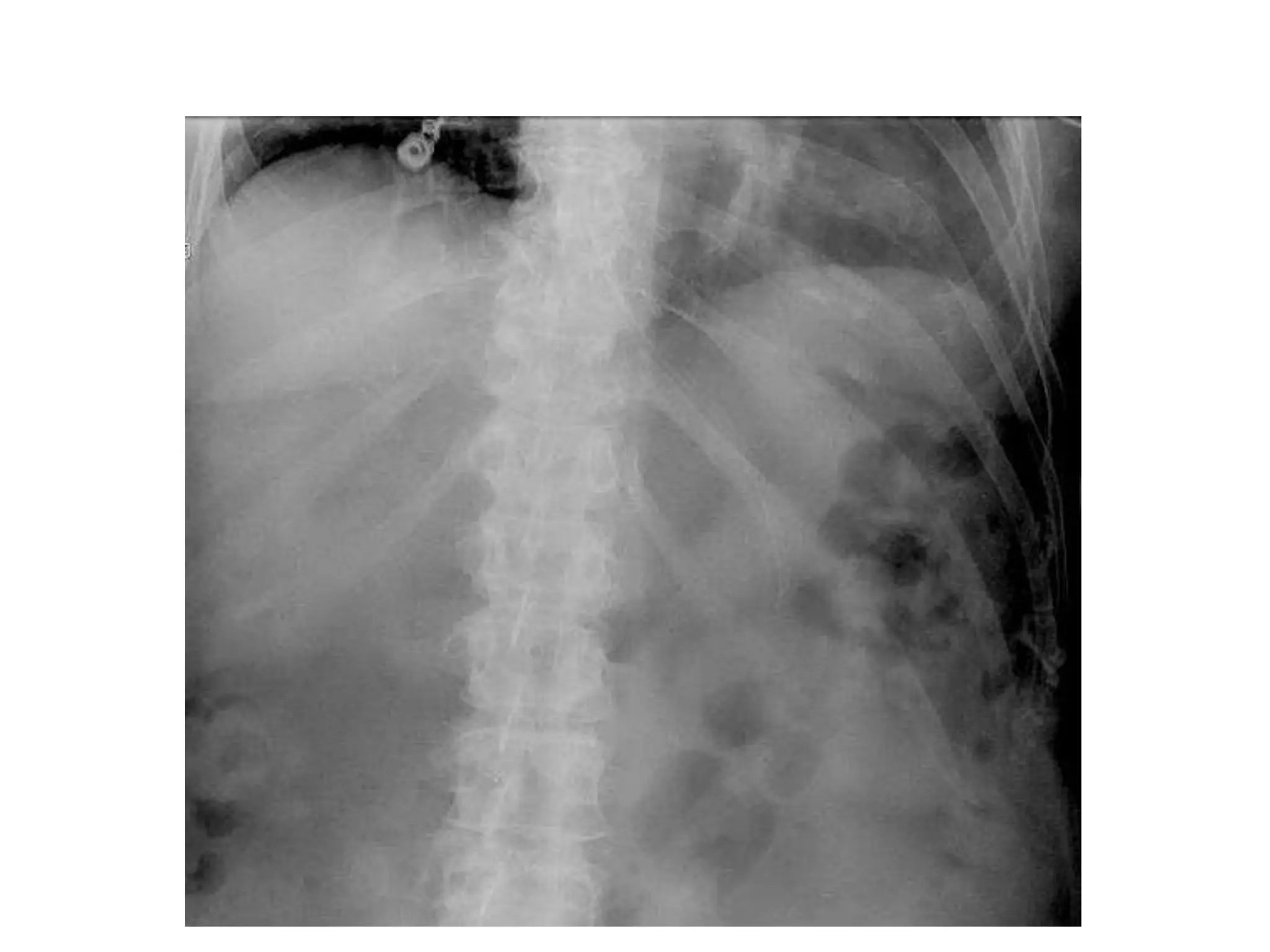Lines and tubes in xray | PPTX