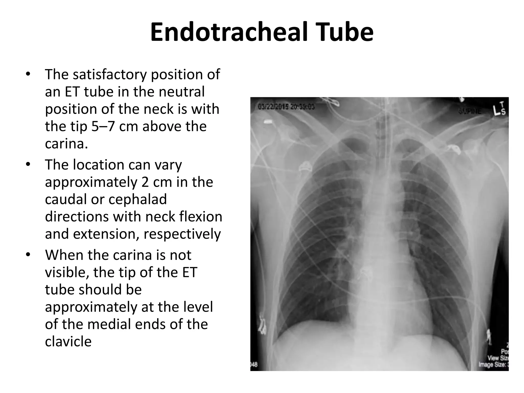 Lines and tubes in xray | PPTX
