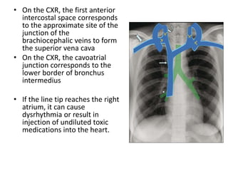 Lines and tubes in xray | PPTX