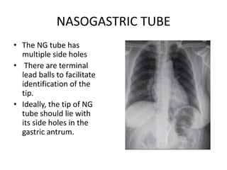 Lines and tubes in xray | PPTX