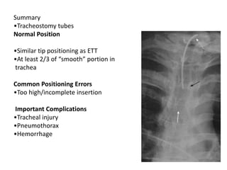 Lines and tubes in xray | PPTX