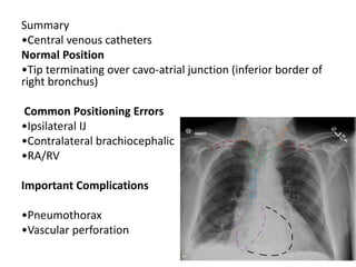 Lines and tubes in xray | PPTX