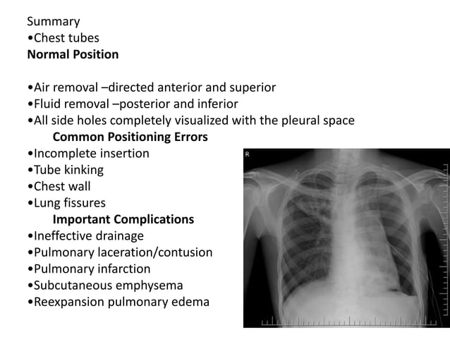 Lines and tubes in xray | PPTX | Heart and Cardiovascular Diseases ...