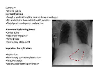 Lines and tubes in xray | PPTX