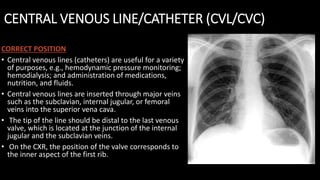 lines and tubes yash (1).pptx