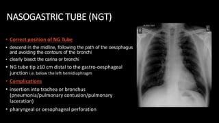 lines and tubes yash (1).pptx