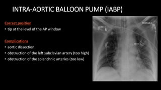 lines and tubes yash (1).pptx