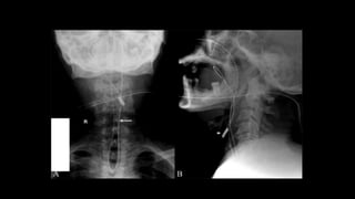 lines and tubes yash (1).pptx