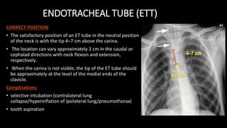 lines and tubes yash (1).pptx