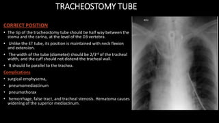 lines and tubes yash (1).pptx