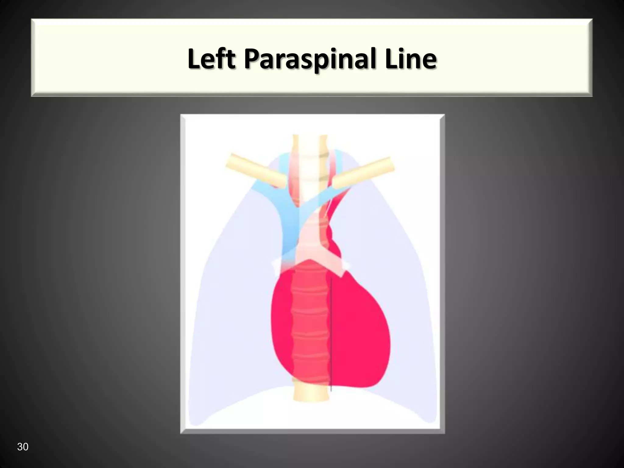 Lines & mediastinal stripes 02 | PPTX