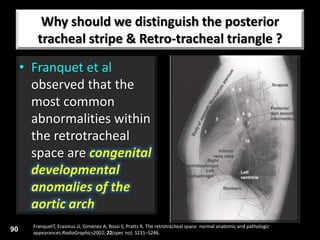 Lines & mediastinal stripes 02 | PPTX
