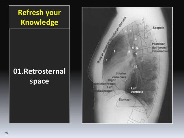 Lines & mediastinal stripes 02