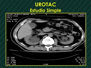 Linfangiectasia renal Bilateral | PPT