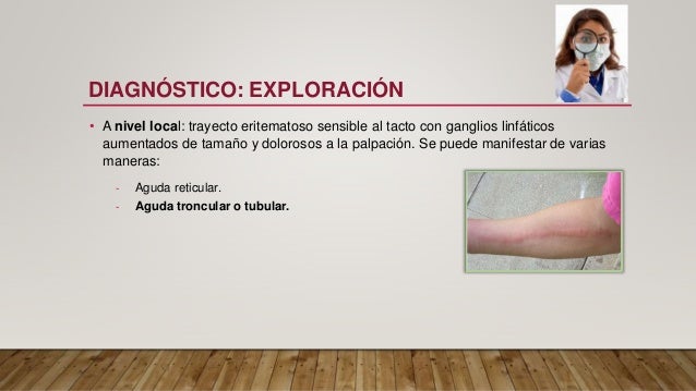 (2018-01-18) Linfangitis. A propósito de un caso(PPT)