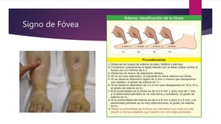 Linfedema.pptx