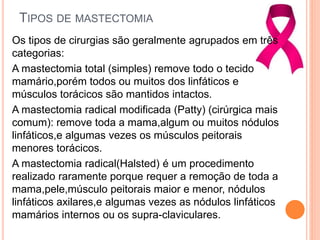 Linfedema pós mastectomia | PPTX