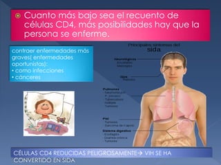 Linfocitos cd4 e importancia en el sida FISIOLOGIA | PPTX
