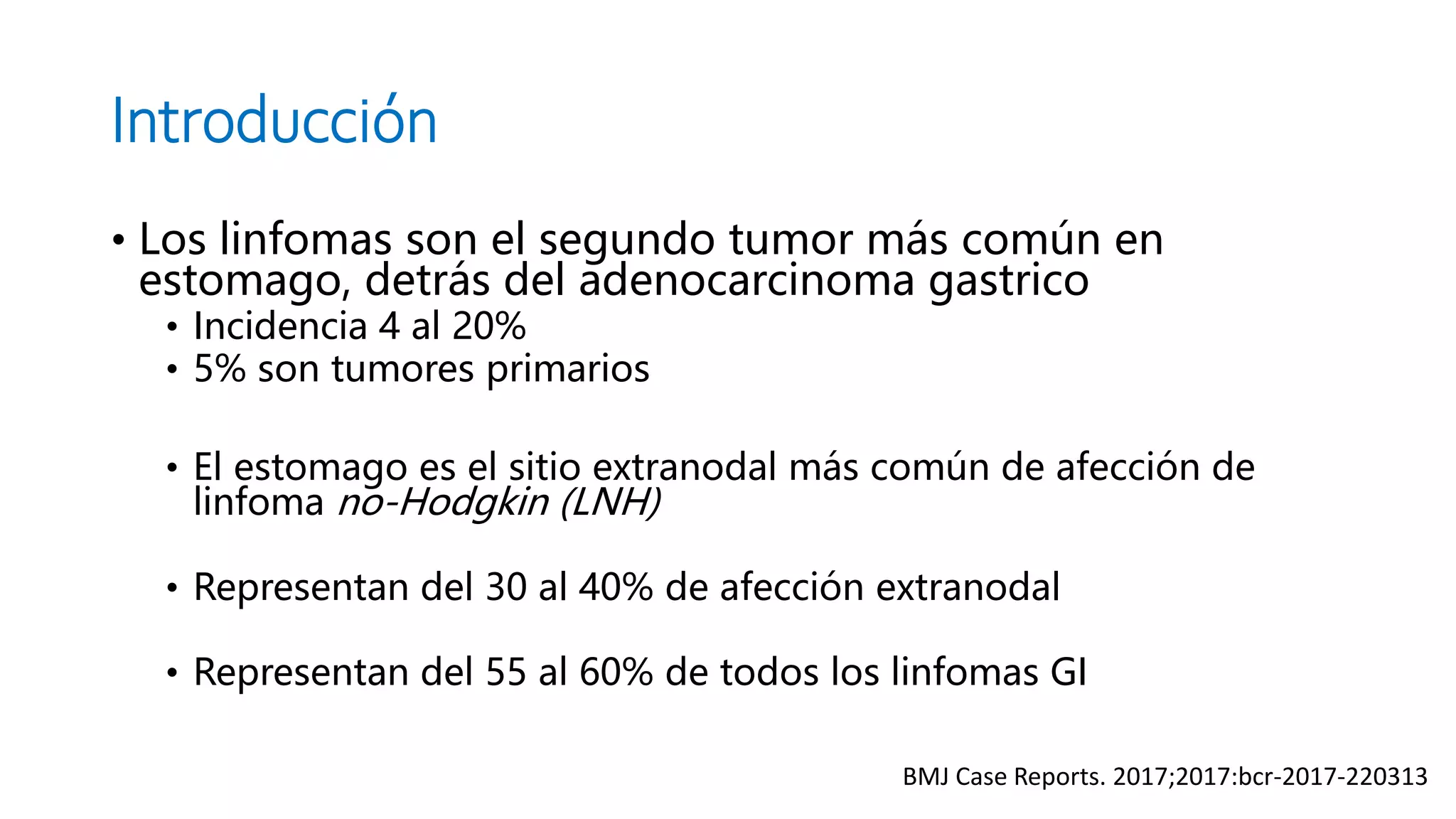 Linfoma Gastrointestinal Primario.pptx