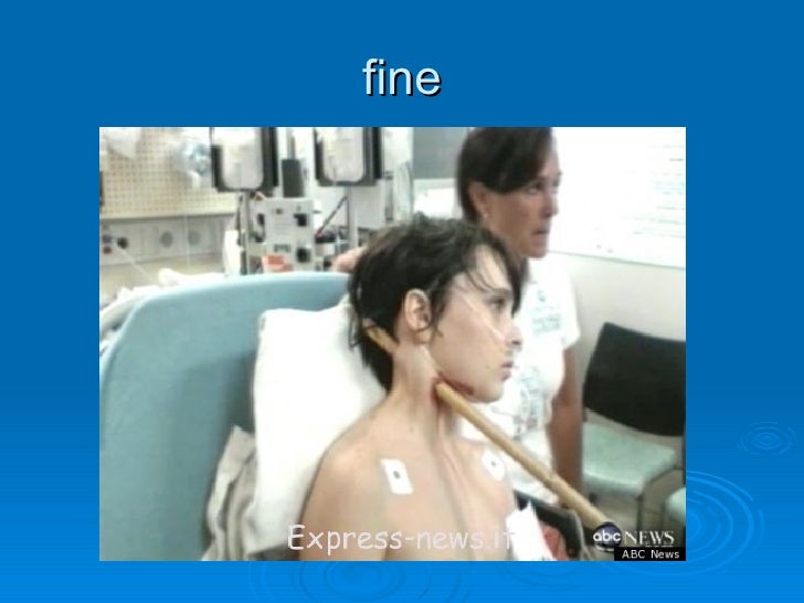 Linfonodi Della Testa E Del Collo Wikipedia