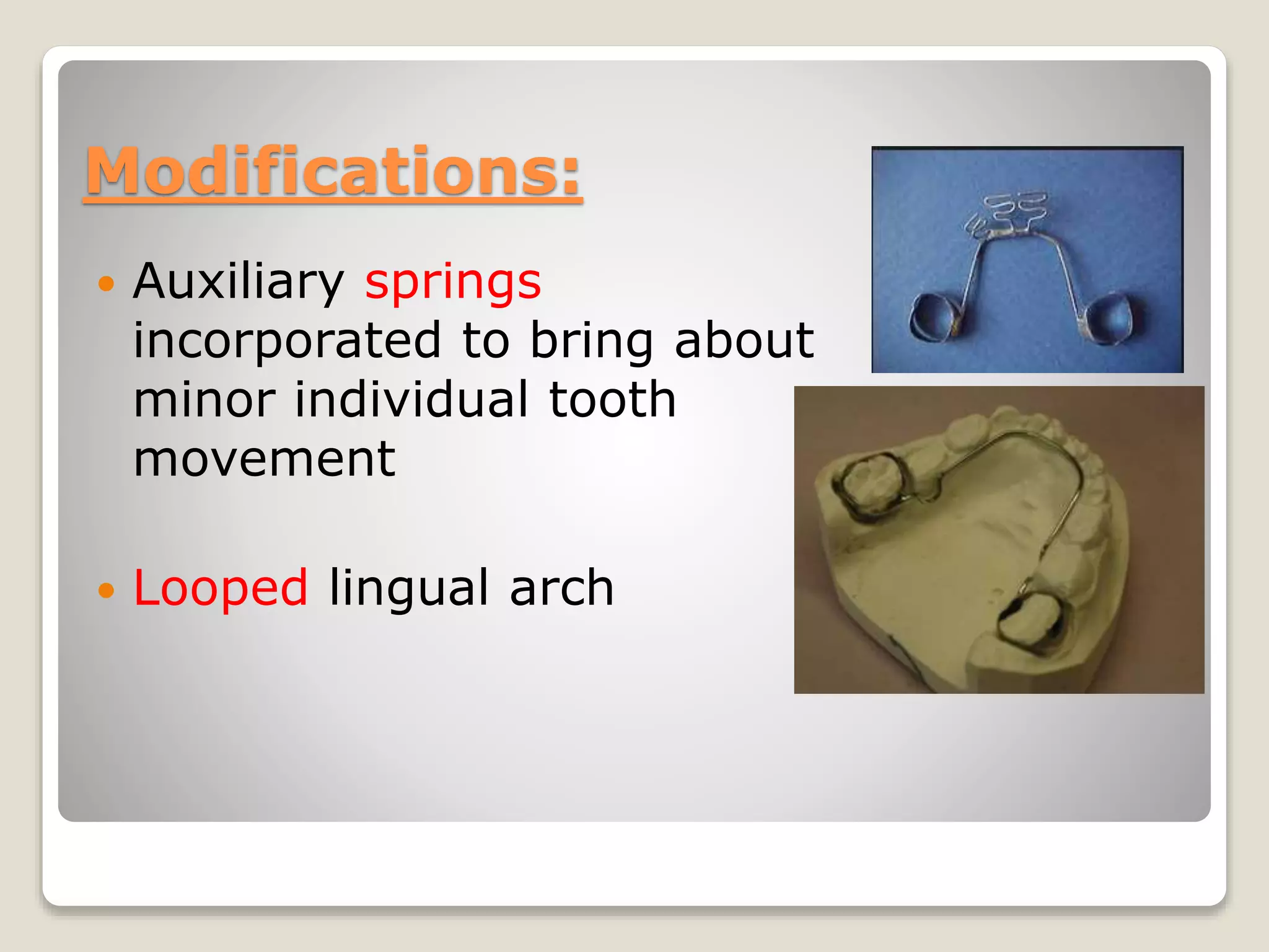 Lingual arch space maintainer | PPTX