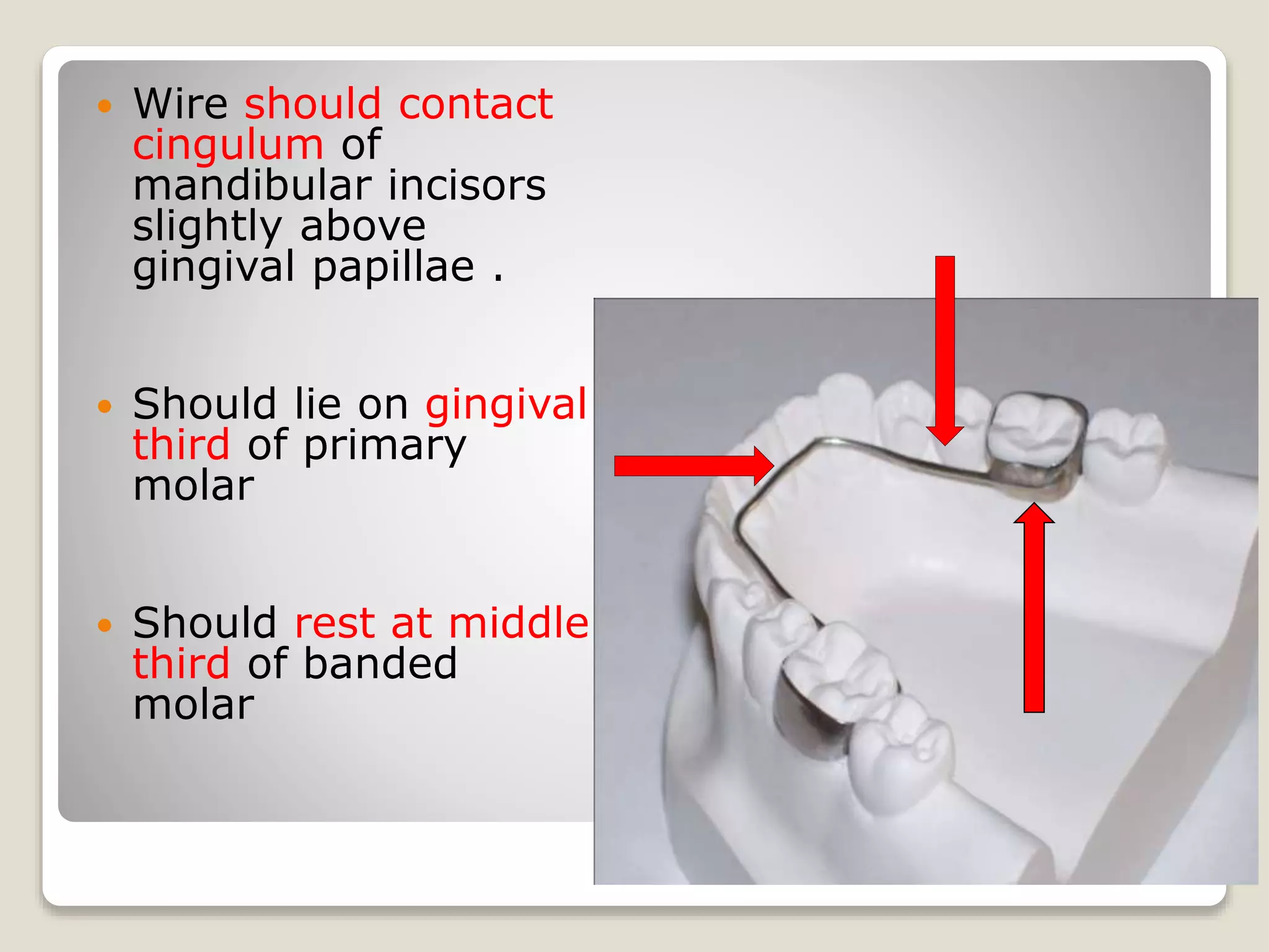 Lingual arch space maintainer | PPTX