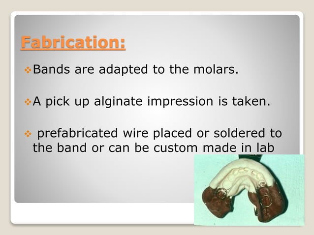 Lingual arch space maintainer | PPTX | Oral care | Personal Care