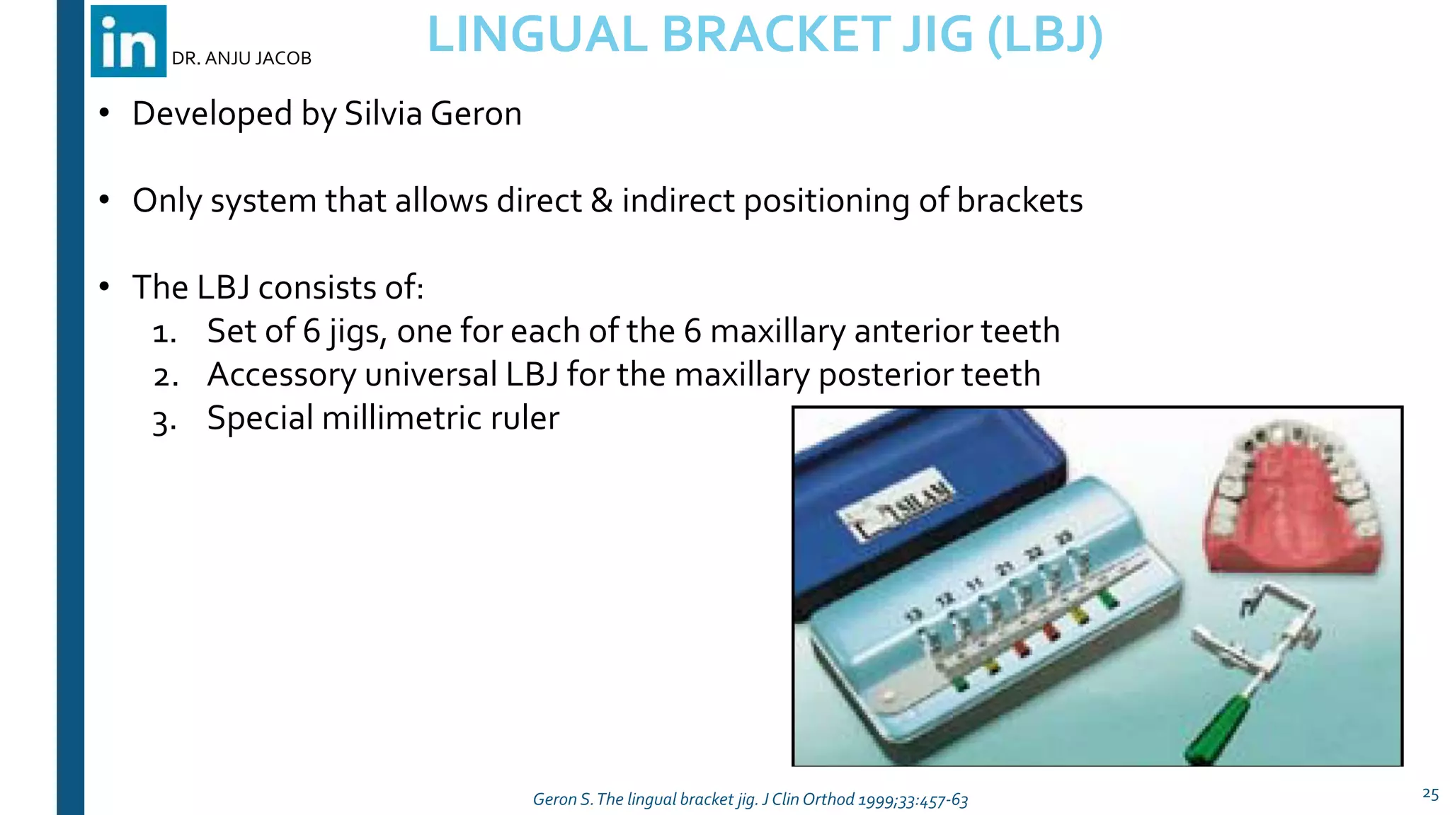 Lingual Orthodontics (Lingual Brackets & Lingual Bonding) | PPTX