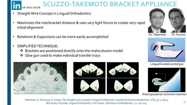 Lingual Orthodontics (Lingual Brackets & Lingual Bonding) | PPTX | Dental Health | Diseases and ...