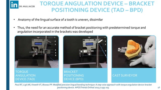 Lingual Orthodontics (Lingual Brackets & Lingual Bonding) | PPTX ...