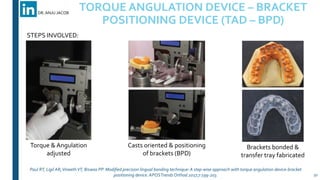 Lingual Orthodontics (Lingual Brackets & Lingual Bonding) | PPTX ...