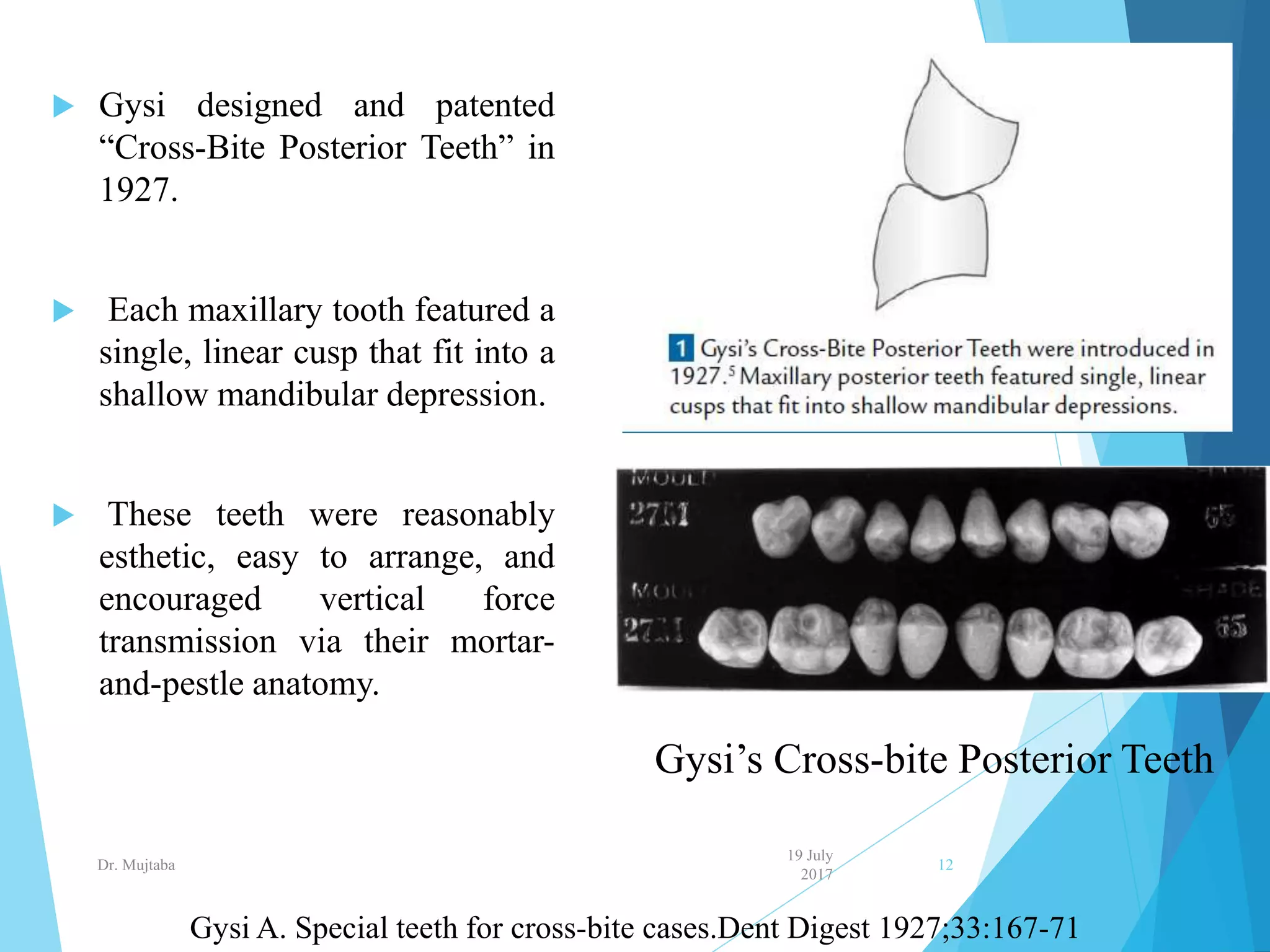 Lingualized occlusion in rdp | PPTX