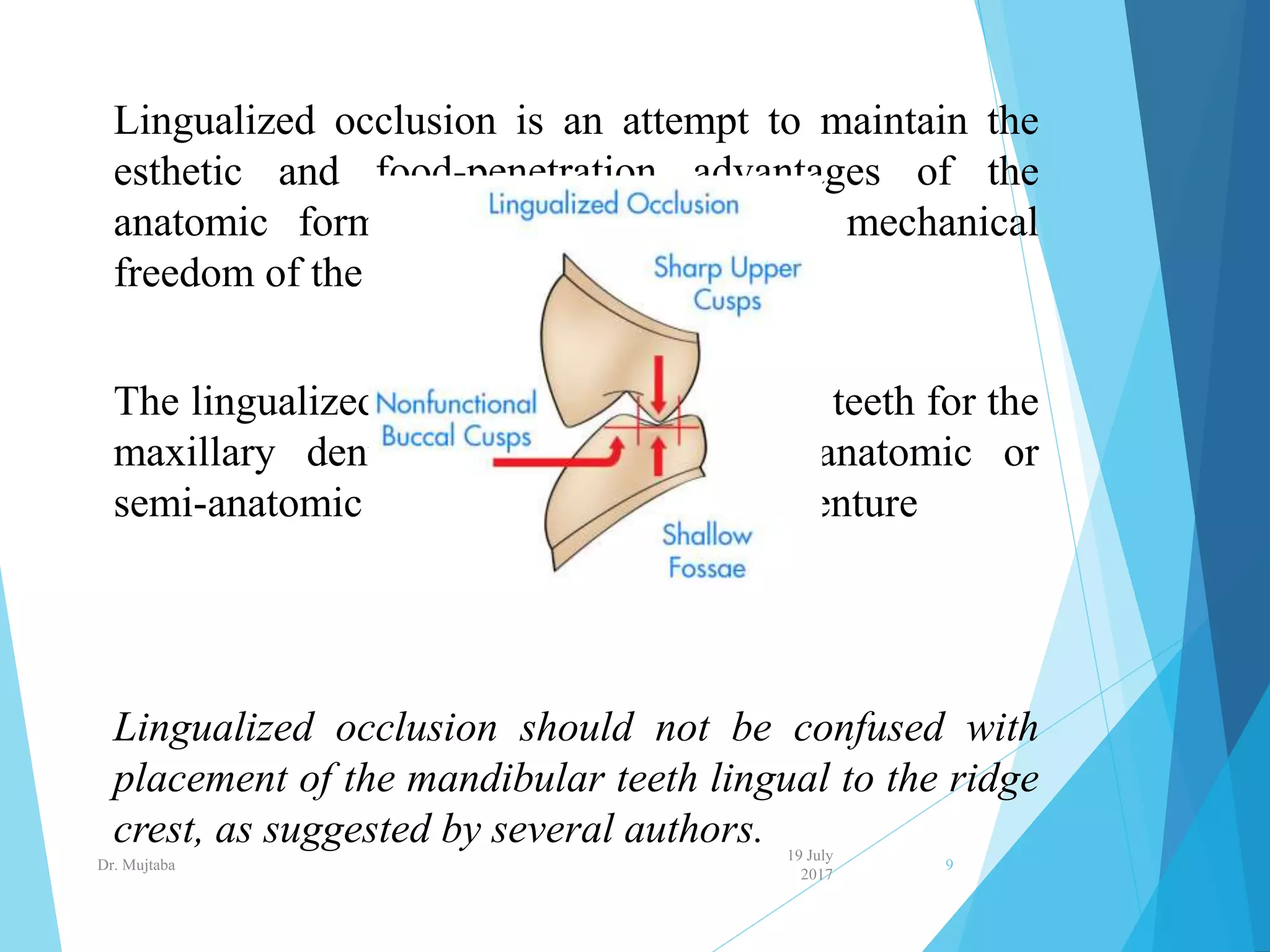 Lingualized occlusion in rdp | PPTX