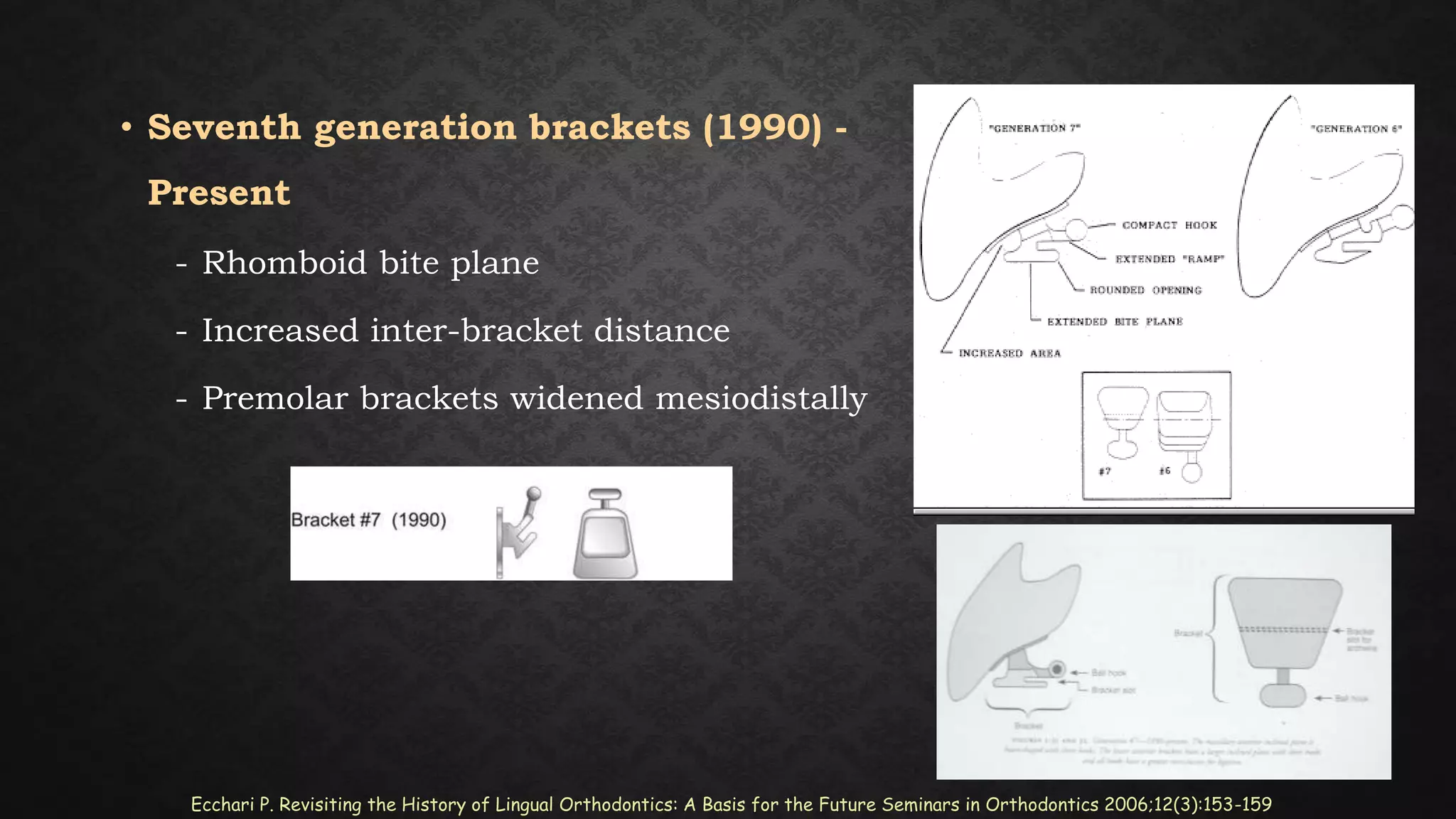 Lingual Orthodontics Khush | PPTX | Oral care | Personal Care